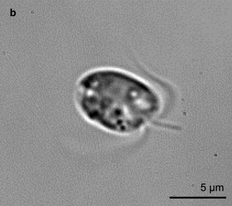 Co zatruło Odrę? Daje toksyczne zakwity! Czym jest Prymnesium parvum ...